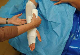 Plaster application